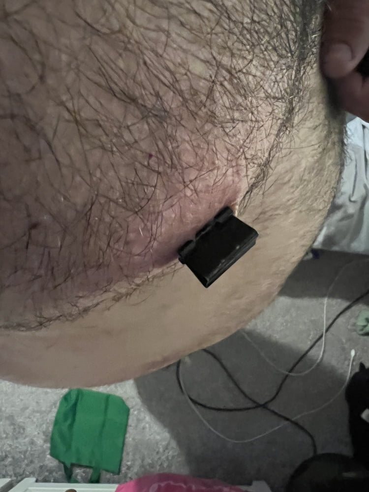 Cock Bondage Until They Turn Purple 3 Pics Xhamster