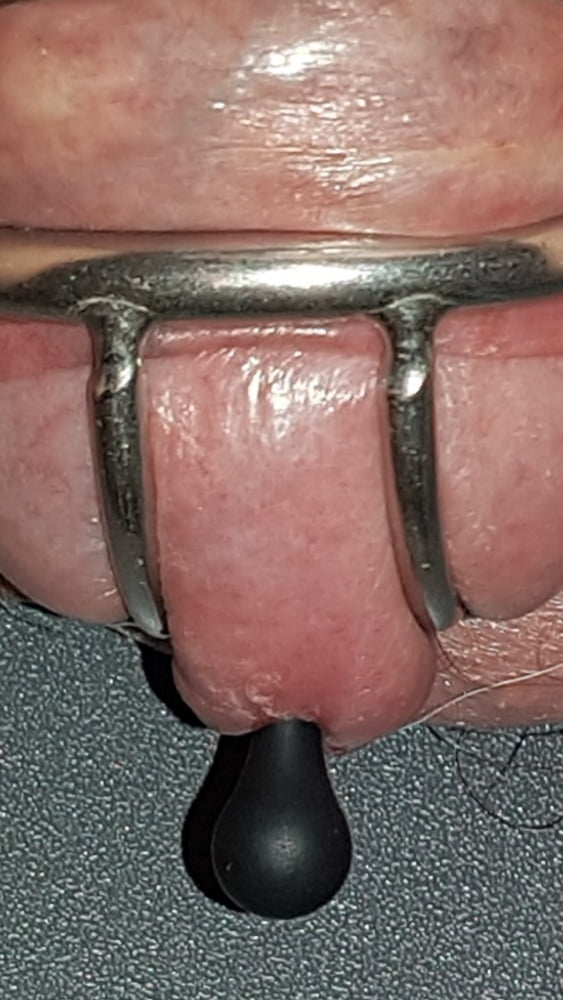 Urethral Insertion 80 Pics Xhamster